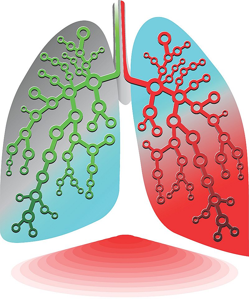 Pulmonālās hipertensijas slimnieki atbalstu var meklēt savā biedrībā ...