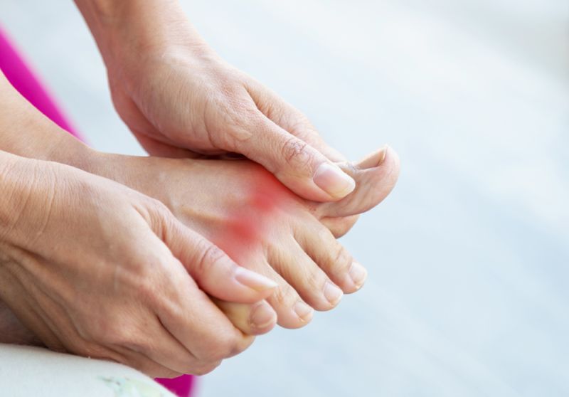 Krietnu maltīšu cienītāju slimība – podagra! Simptomi un pareiza ...